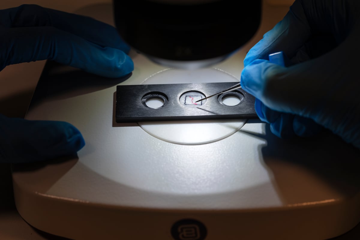 ¿Cuántos microplásticos se almacenan en nuestros pulmones? Un estudio ...