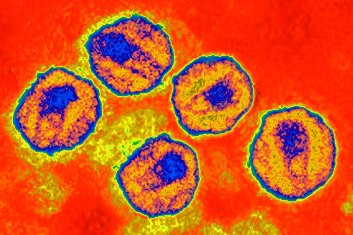 Médicos de EE UU anuncian la primera curación de una mujer con VIH ...