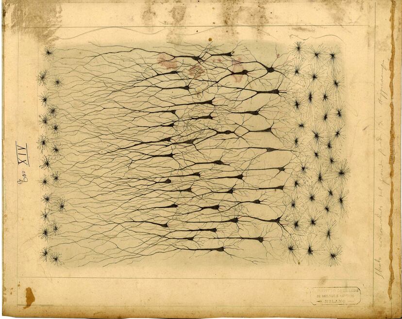 La pelea entre dos hermanos siameses que iluminó la sustancia del ...