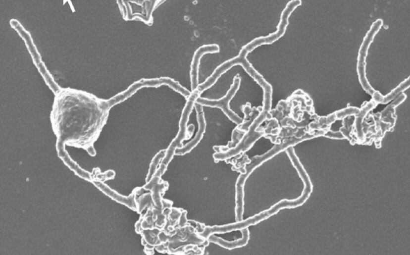 Arqueas de Asgard: Hallado el organismo que explica el origen de toda ...