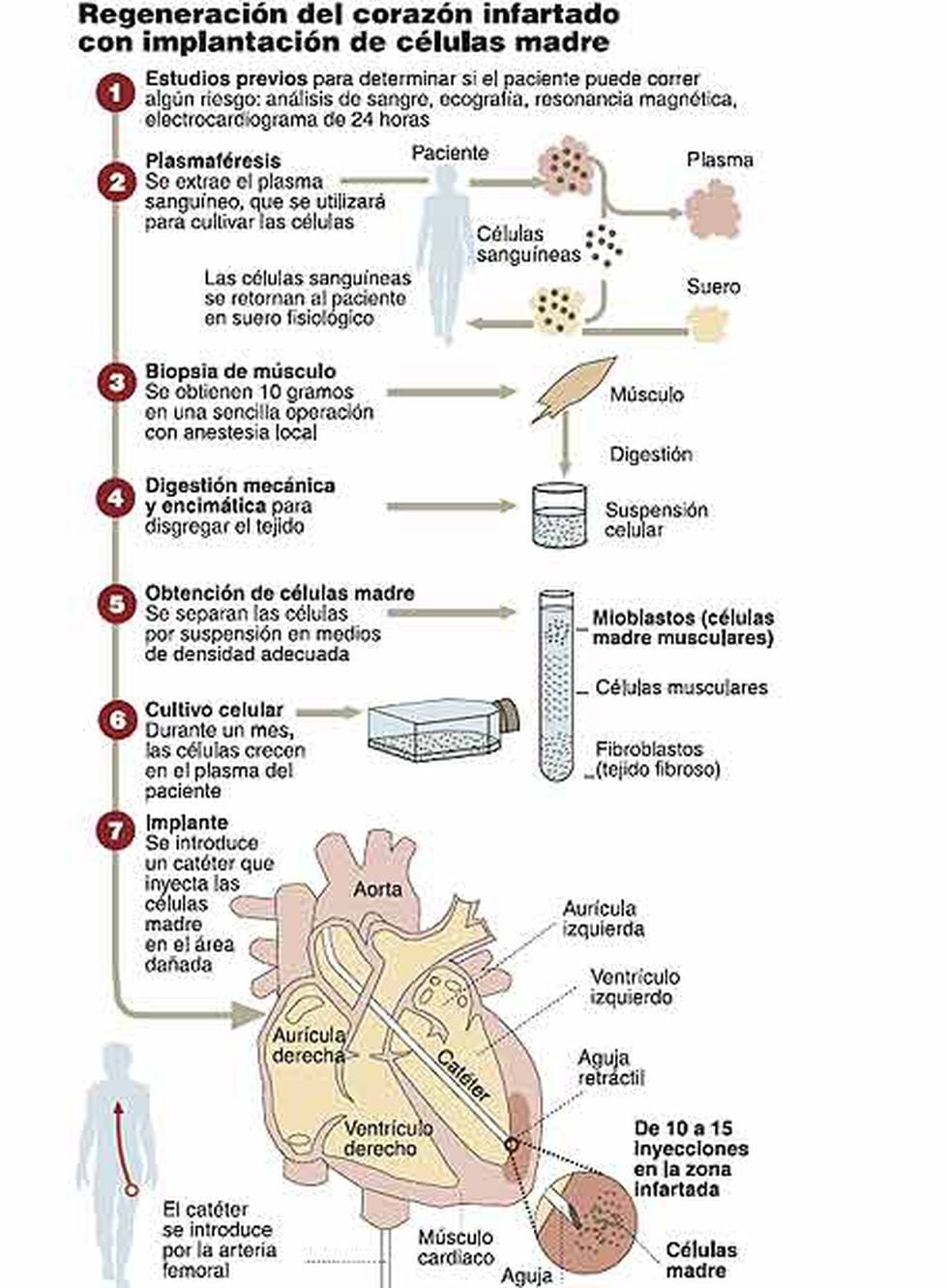 Regeneración del corazón infartado | Salud | EL PAÍS