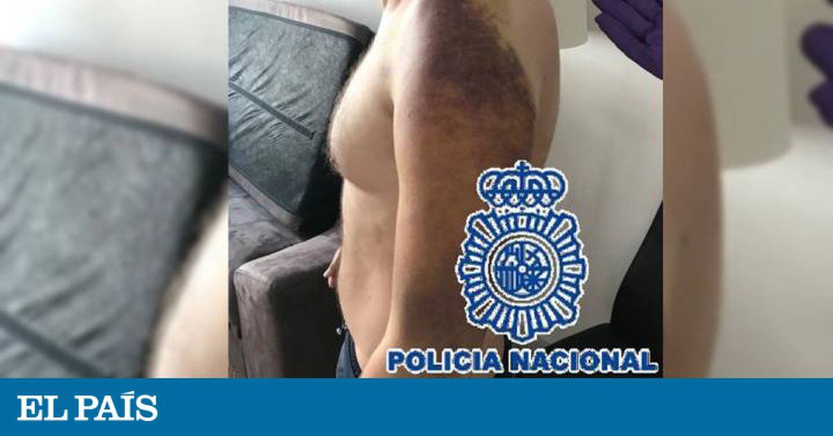 La Policía Libera En Marbella A Un Presunto Narco Secuestrado Durante